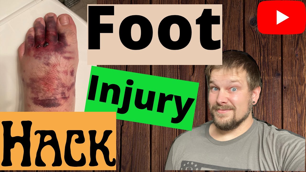 Foot Injury Hack ( 2022 - YouTube