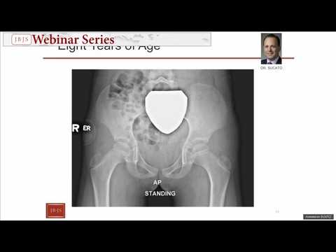 Webinar: DDH in Infants: The Pavlik Harness and Beyond - YouTube