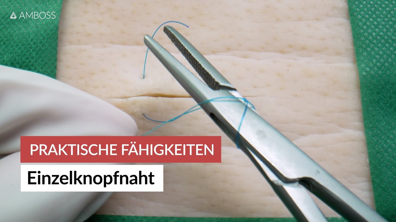 Op Klammern Entfernen Tut Das Weh - Baby Schwanger