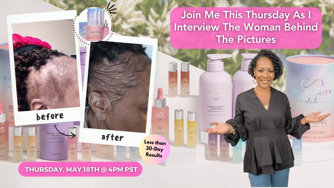 "From Alopecia to Hair Growth: A Journey of Hair Regrowth and Renewal ...