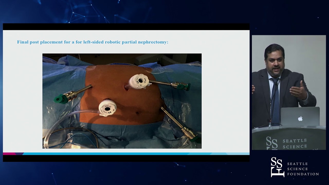 Transperitoneal Partial Nephrectomy: Patient Positioning Port Placement ...