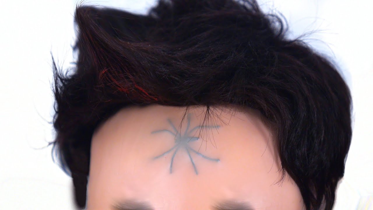 SPIDER CRAWLS UNDER SKIN! - YouTube