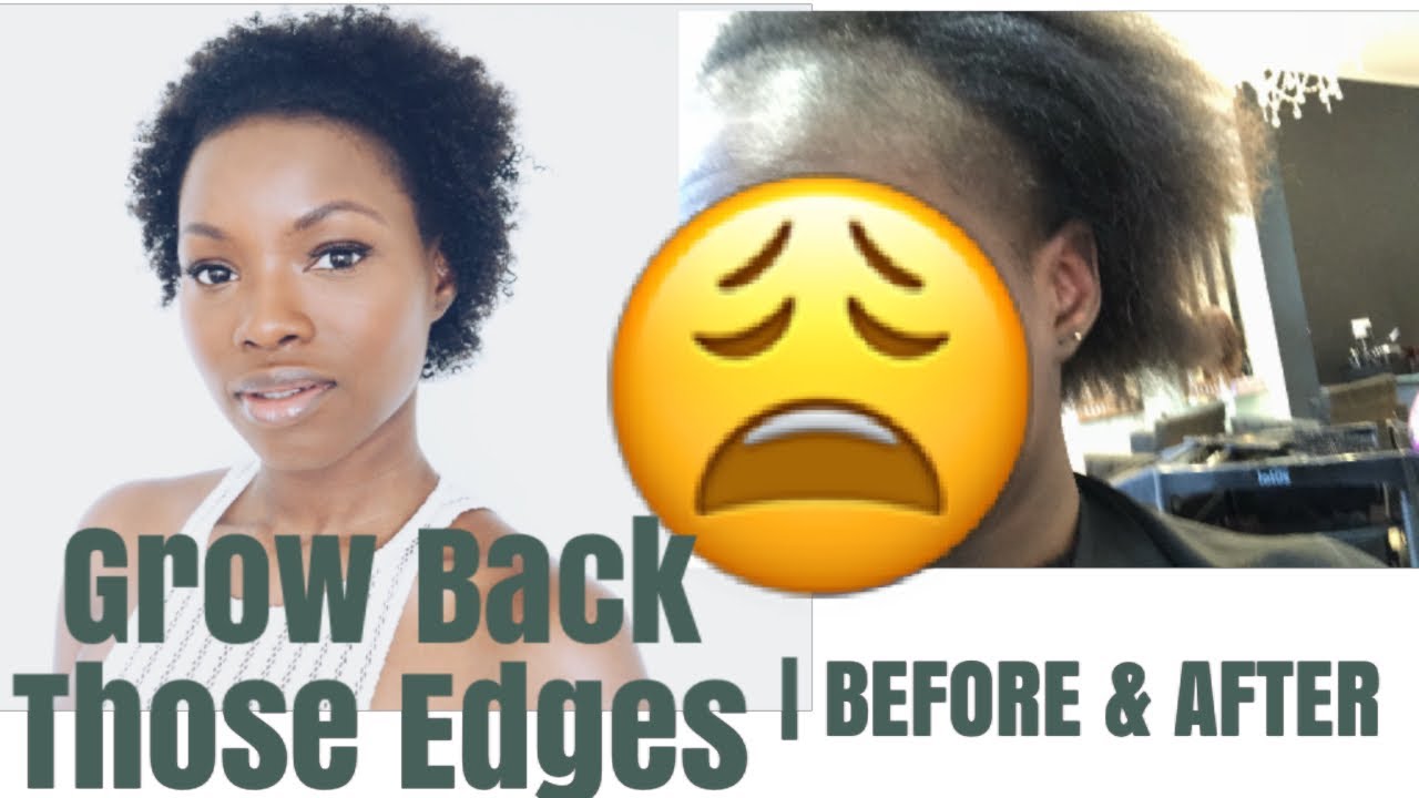 Grow Your Bald Edges Back | Before and After - YouTube