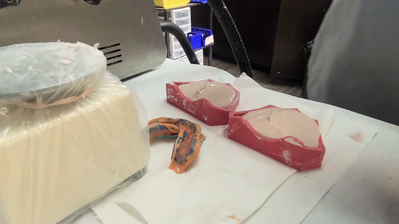 mounting cast models for dentures. - YouTube