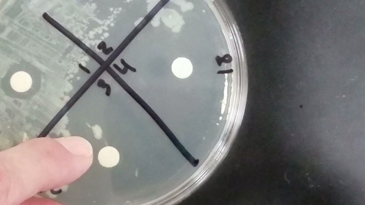 Microbiology Lab 18 Results E. coli - YouTube