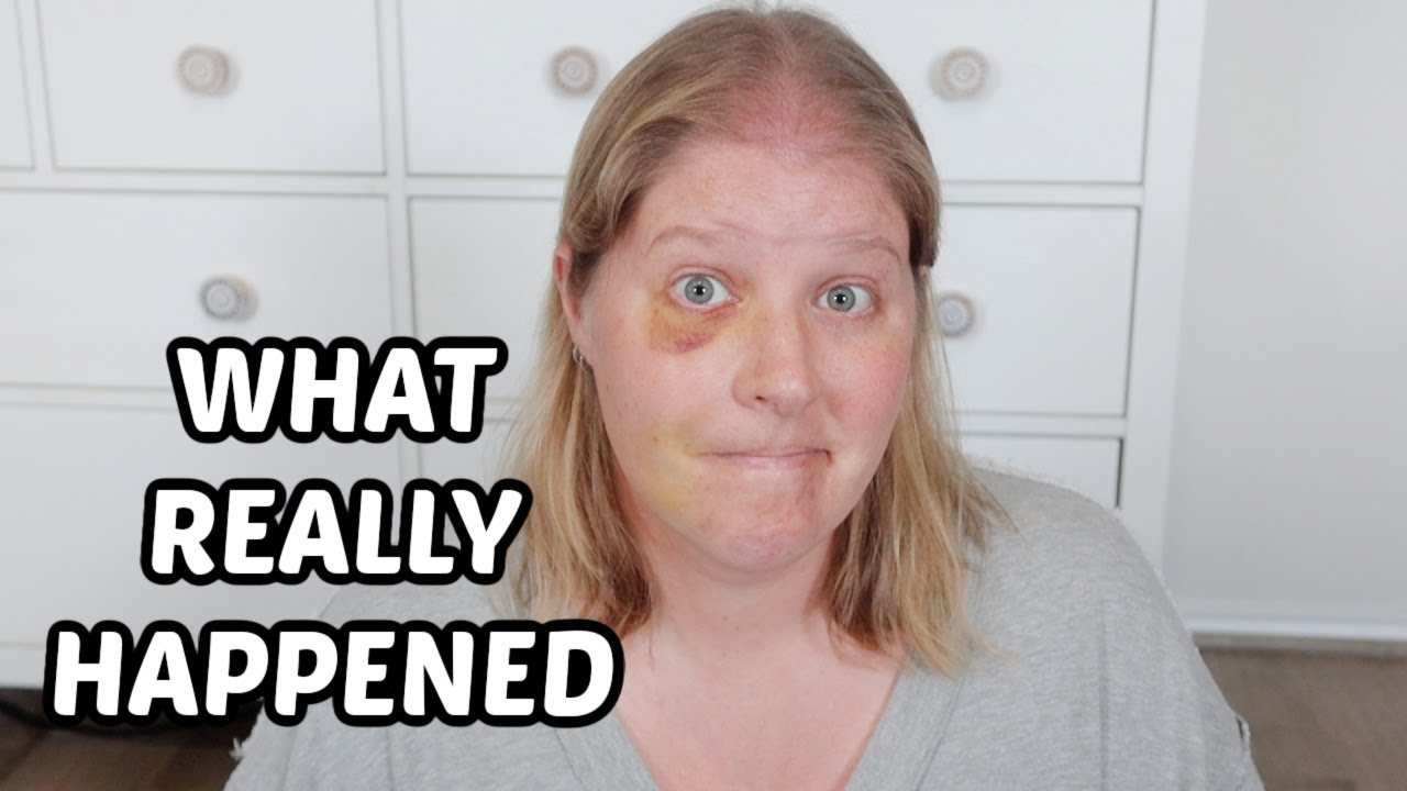 Surgery Story & Update - YouTube