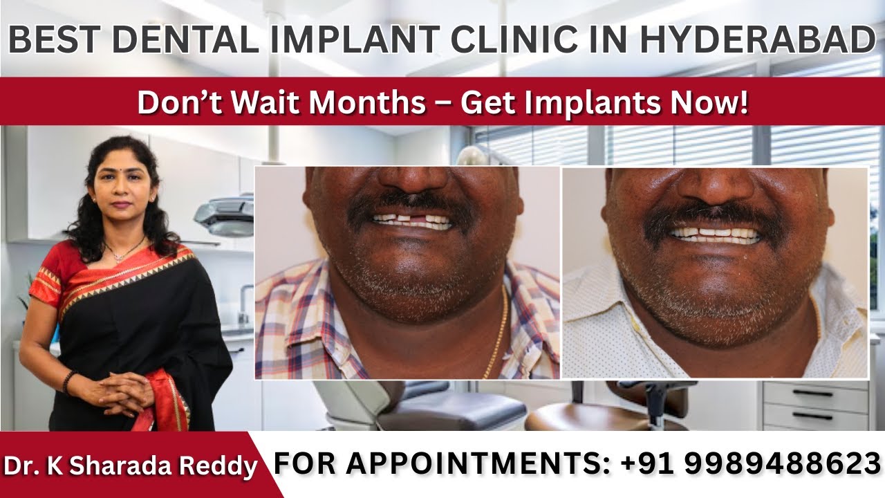 Best Dental Implant Clinic in Hyderabad | Top Dentist for Full Mouth ...