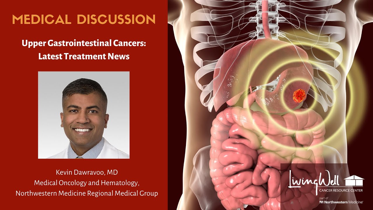 Upper GI Cancers: The Latest Treatment Options - YouTube
