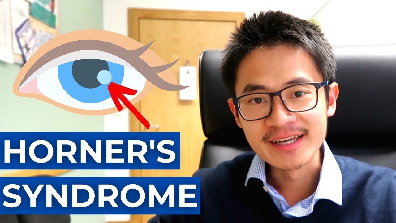 What you need to know about Horner's syndrome - YouTube