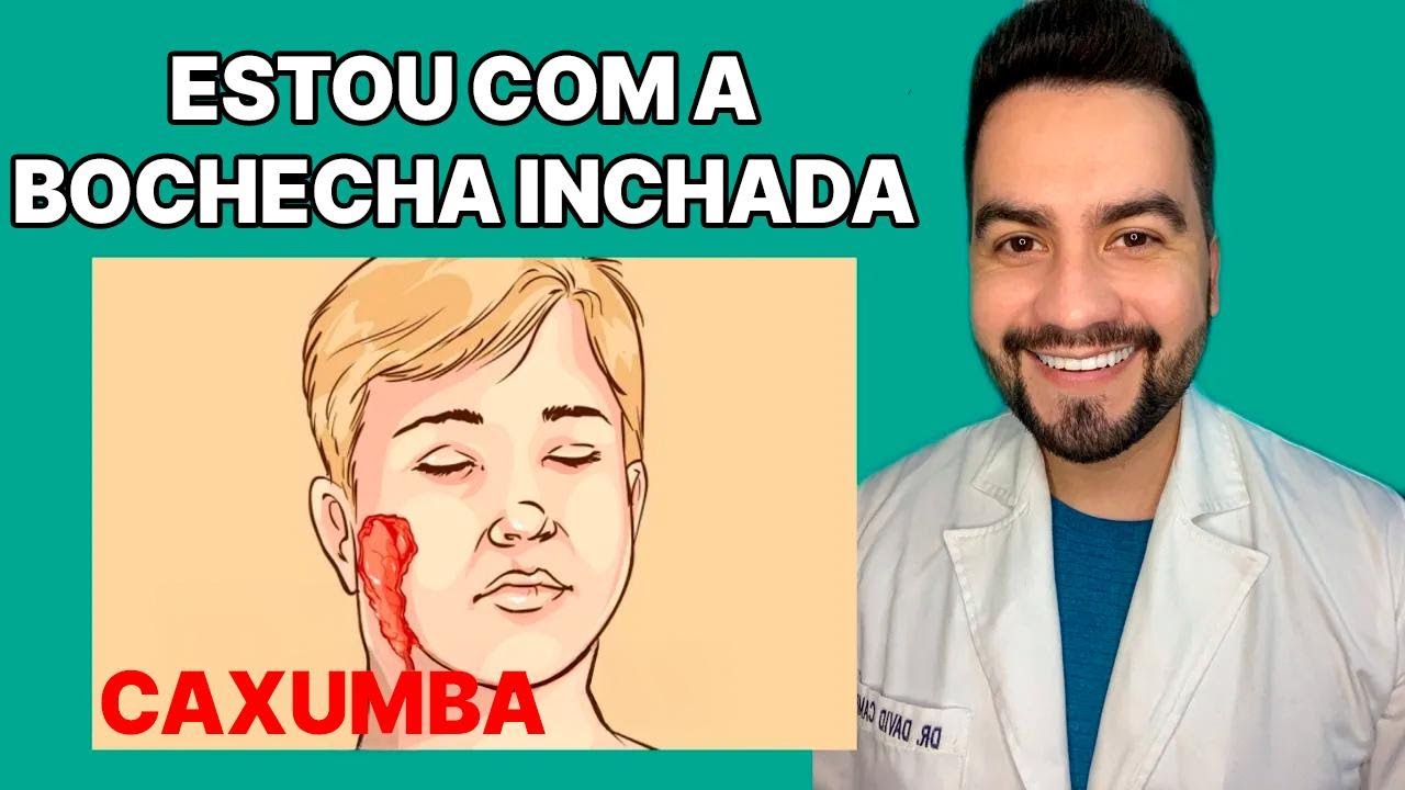 Meu Rosto Ficou Inchado: Parotidite (Papeira) Explicada pelo Dr. David ...