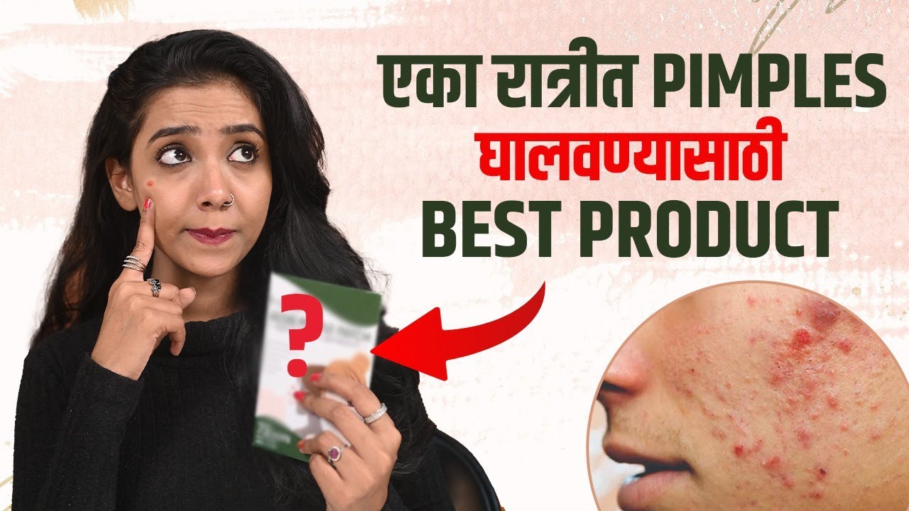 Urban Yog Pimple Patch ने एका रात्रीत Pimple जातात? | Urban Yog Pimple ...