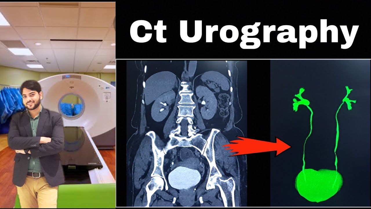 How to make Urogram in CT Urography - Naresh Gehlot . - YouTube