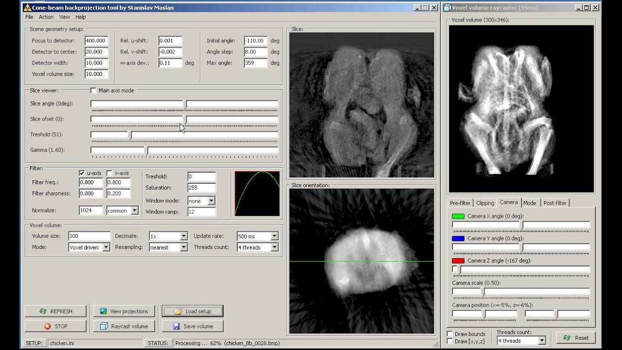 3D x-ray cone beam backprojection - YouTube