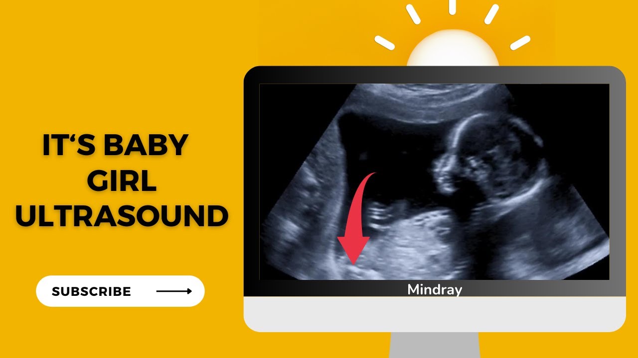 19-Week Baby Girl Ultrasound - YouTube