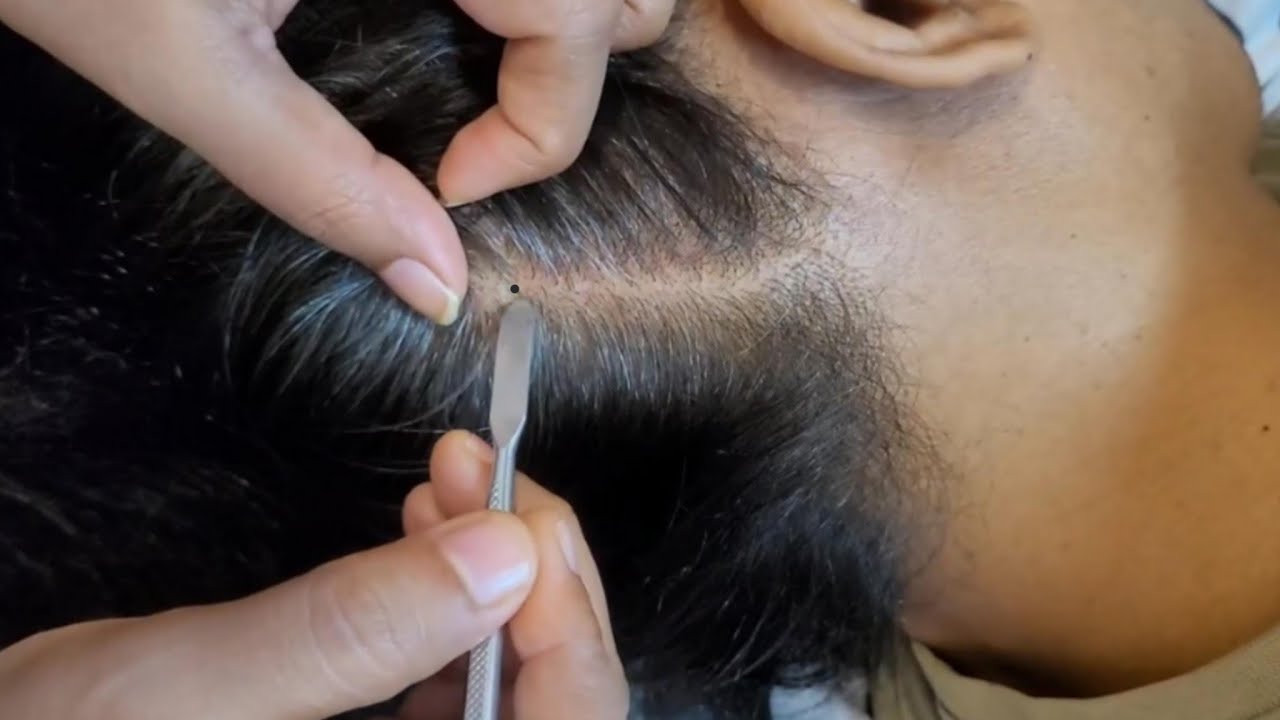 Scalp Check for Tension Relief & ASMR - YouTube