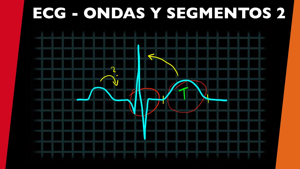 ECG - Ondas, intervalos y segmentos 2 - [visita mi Podcast y aprende ...