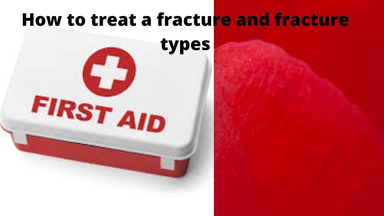 Basic first aid How to treat a fracture and fracture types| First aid ...