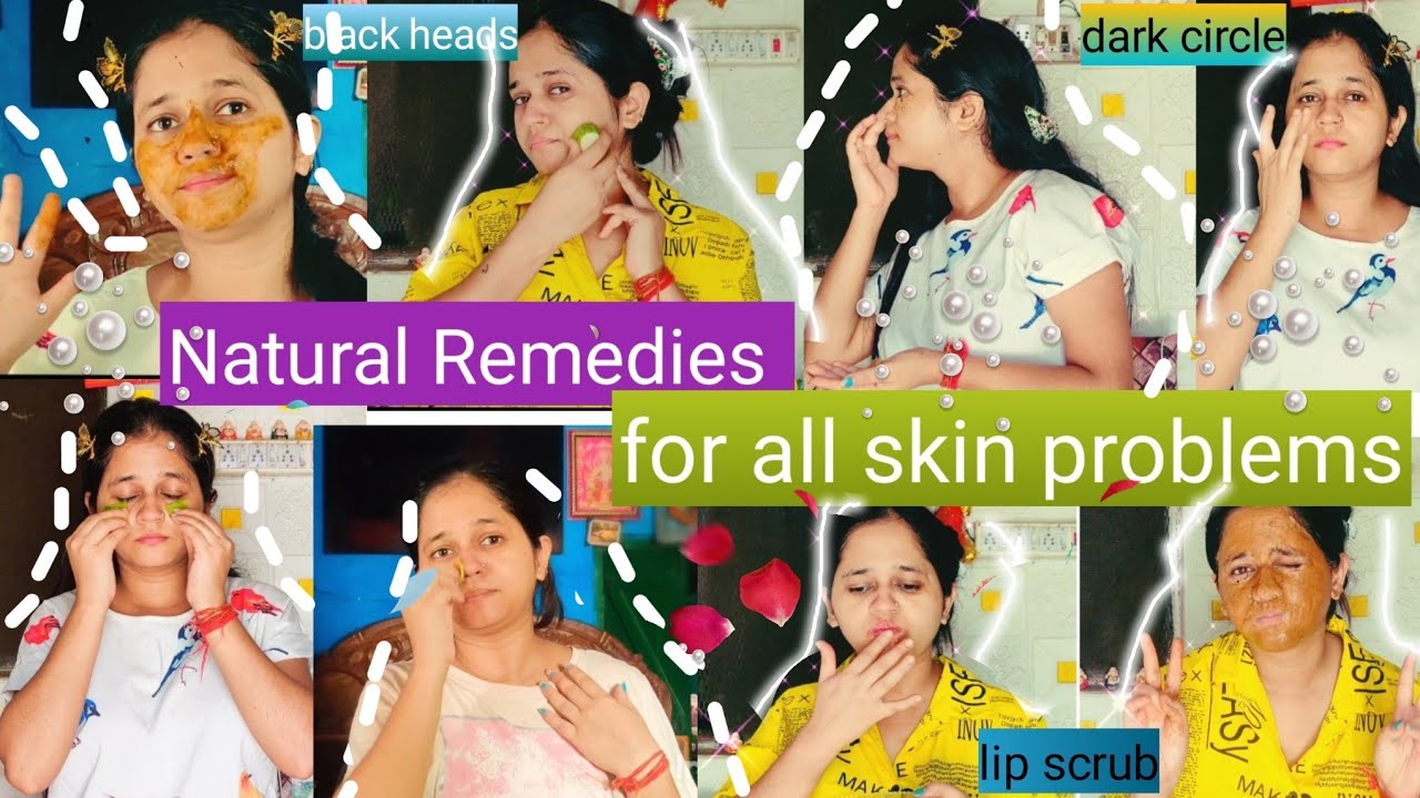 Natural Remedies for all skin problems!🤞🌹 blackheads,darkspots ...