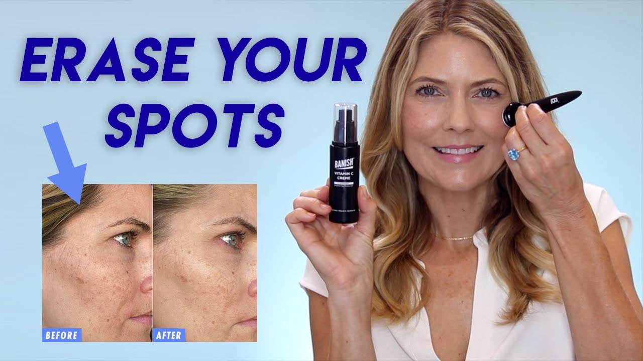 Erase Pigmentation And Scars Fast With The Banisher Microstamping Tool ...