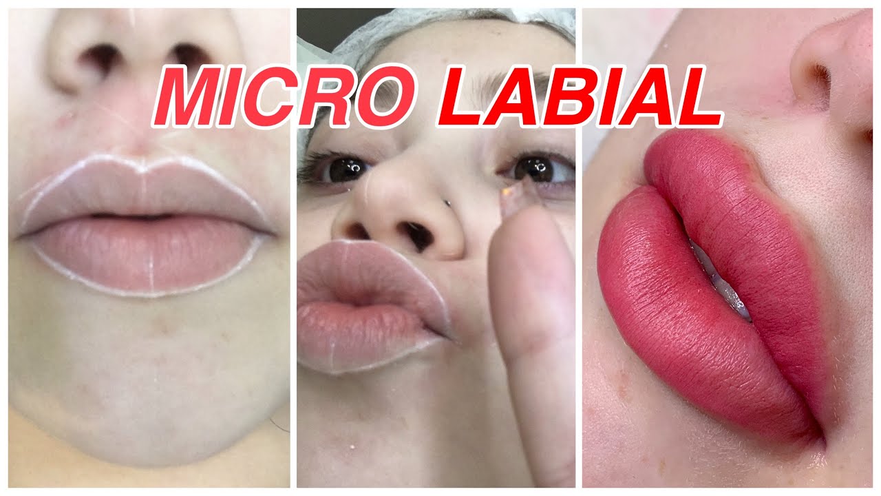 MINHA EXPERIÊNCIA MICRO LABIAL | Maria Cubel - YouTube