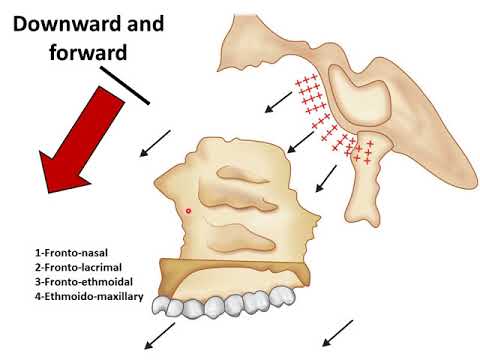 growth of maxilla - YouTube
