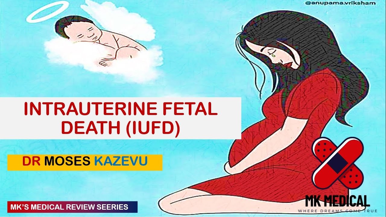 Intrauterine Fetal Demise Death IUFD YouTube Intrauterine Fetal Demise Death IUFD YouTube