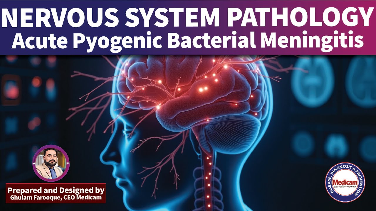 Nervous System Pathology || Acute Pyogenic Bacterial Meningitis - YouTube