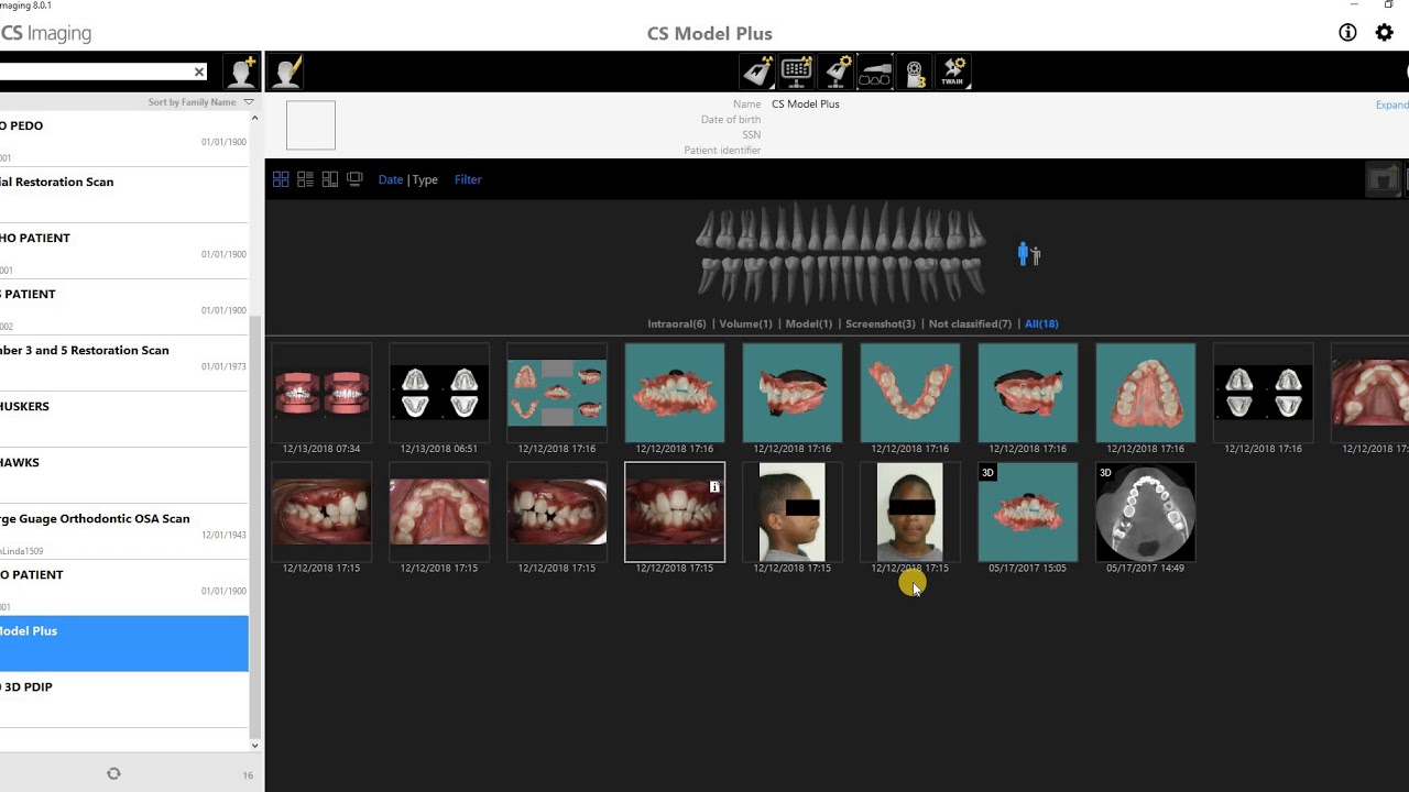 Exporting IO Scans - Carestream Imaging Version 8 - YouTube