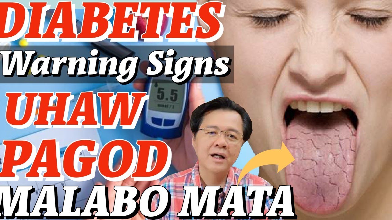 Diabetes Warning Signs: Uhaw, Pagod, Malabo Mata - Payo ni Doc Willie ...