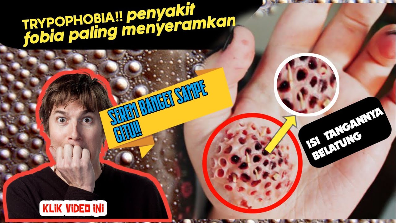 NGERI TUBUH BOLONG BOLONG !! BIKIN GELI !!MENGENAL TRYPOPHOBIA - YouTube