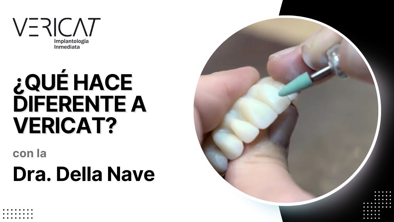 Qué hace diferente a Vericat y cómo es el trato recibido | CLÍNICAS ...