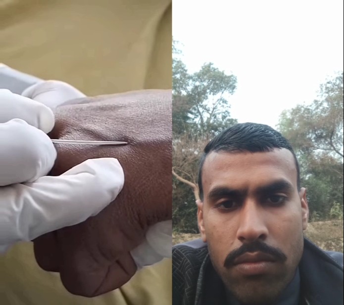 Vigo|injection 💉 लगाने का सही तरीका| #shortvideo #shorts - YouTube