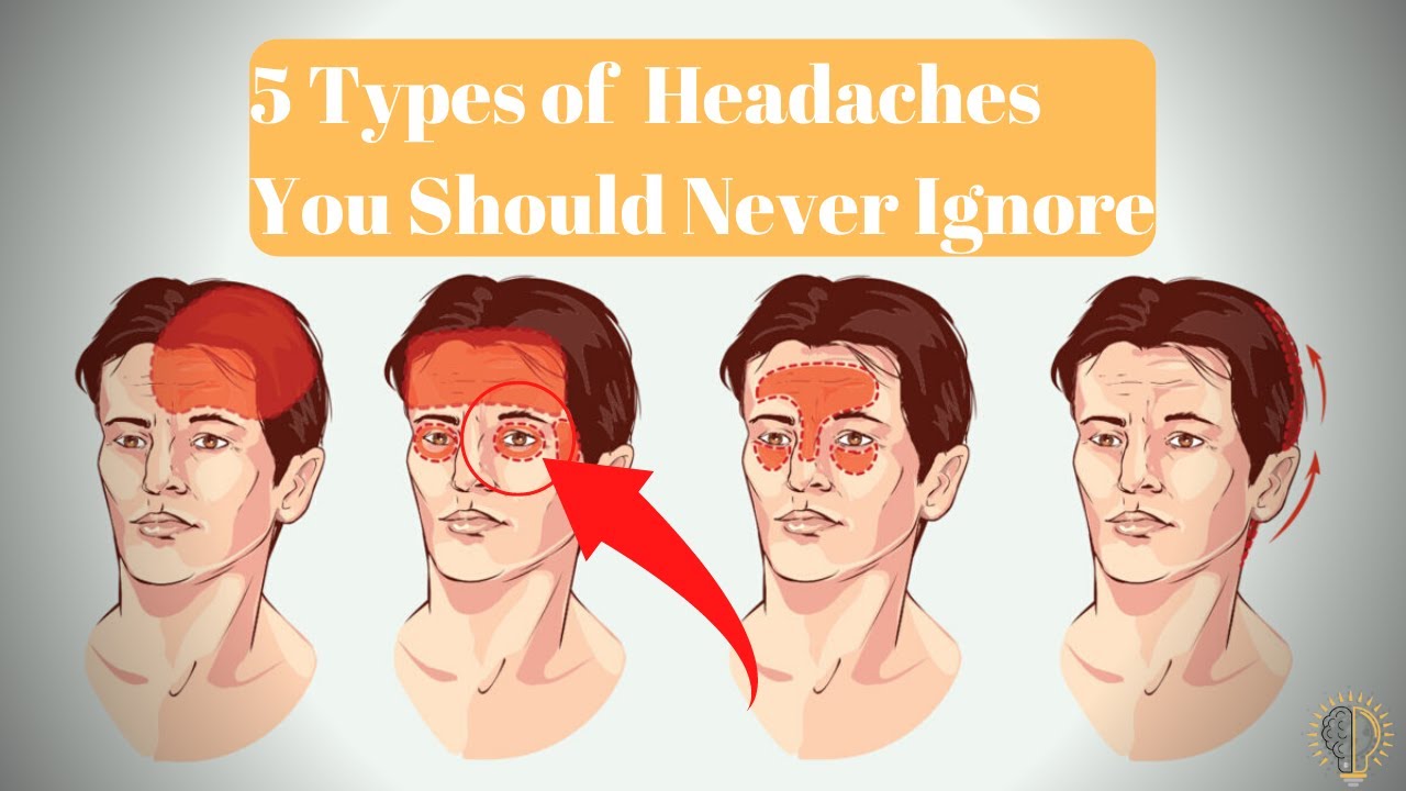 5 Types of Headaches - YouTube