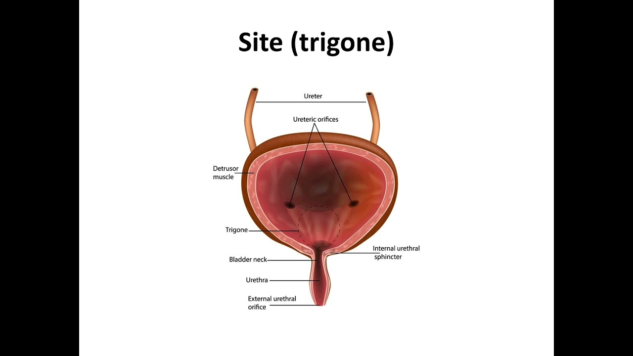URS - 301| pathology | urinary bladder and male l recorded - YouTube