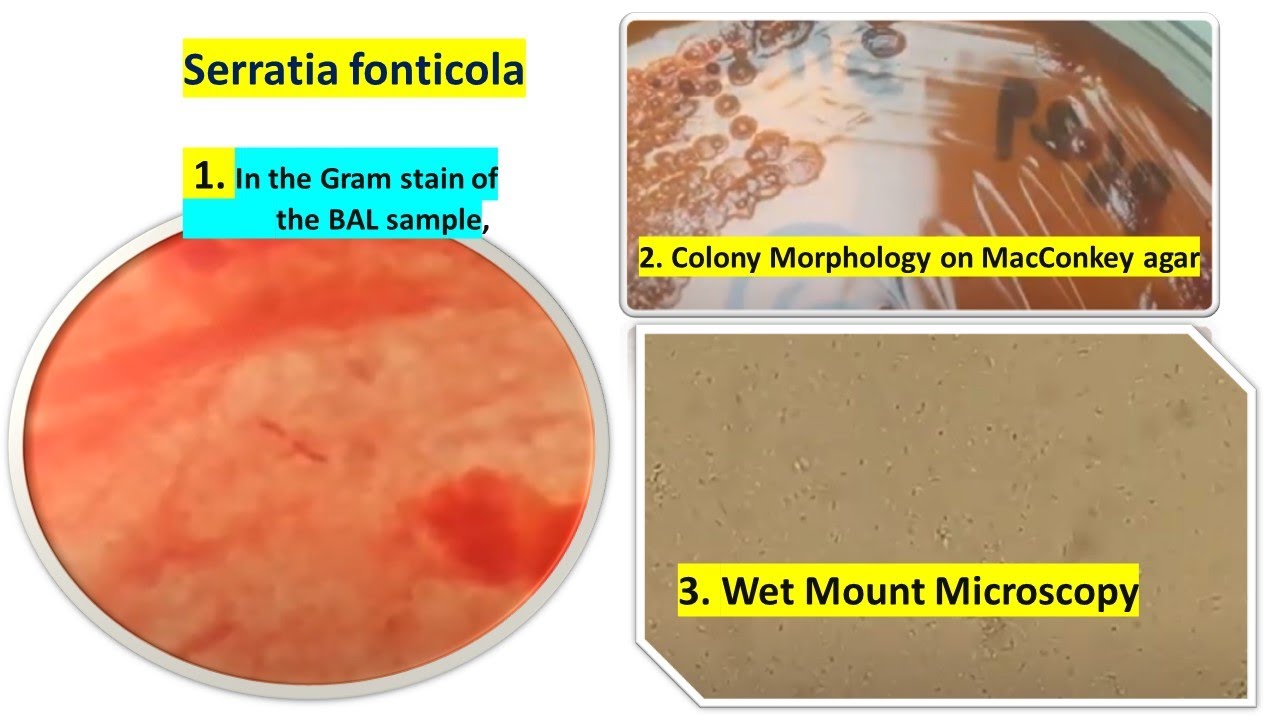 Serratia Marcescens Gram Stain