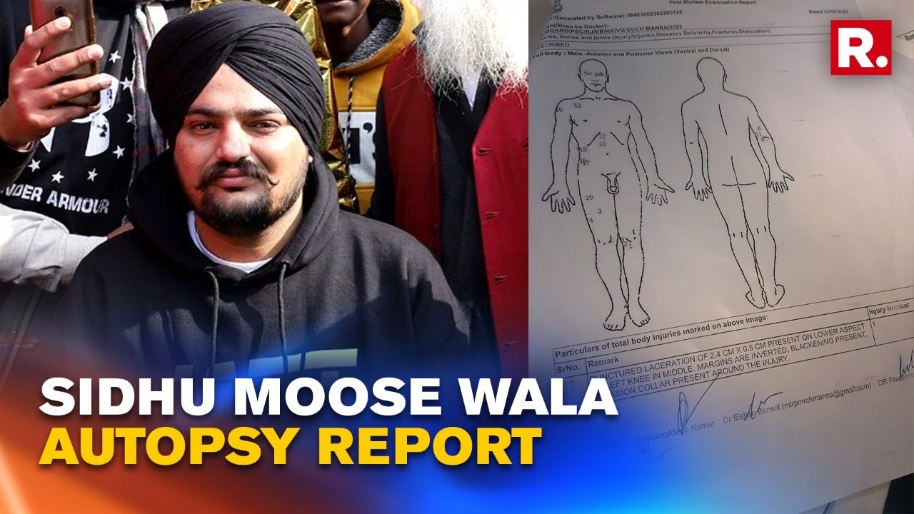 Sidhu Moosewala's Autopsy Report Lists 19 Separate Injuries From Even ...