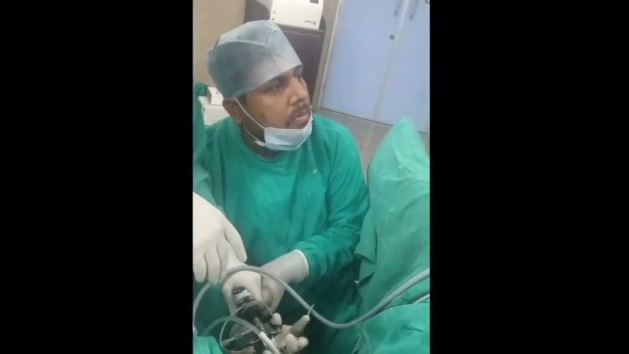 Candidate Ravish Procedure Transurethral Resection Of The Prostate