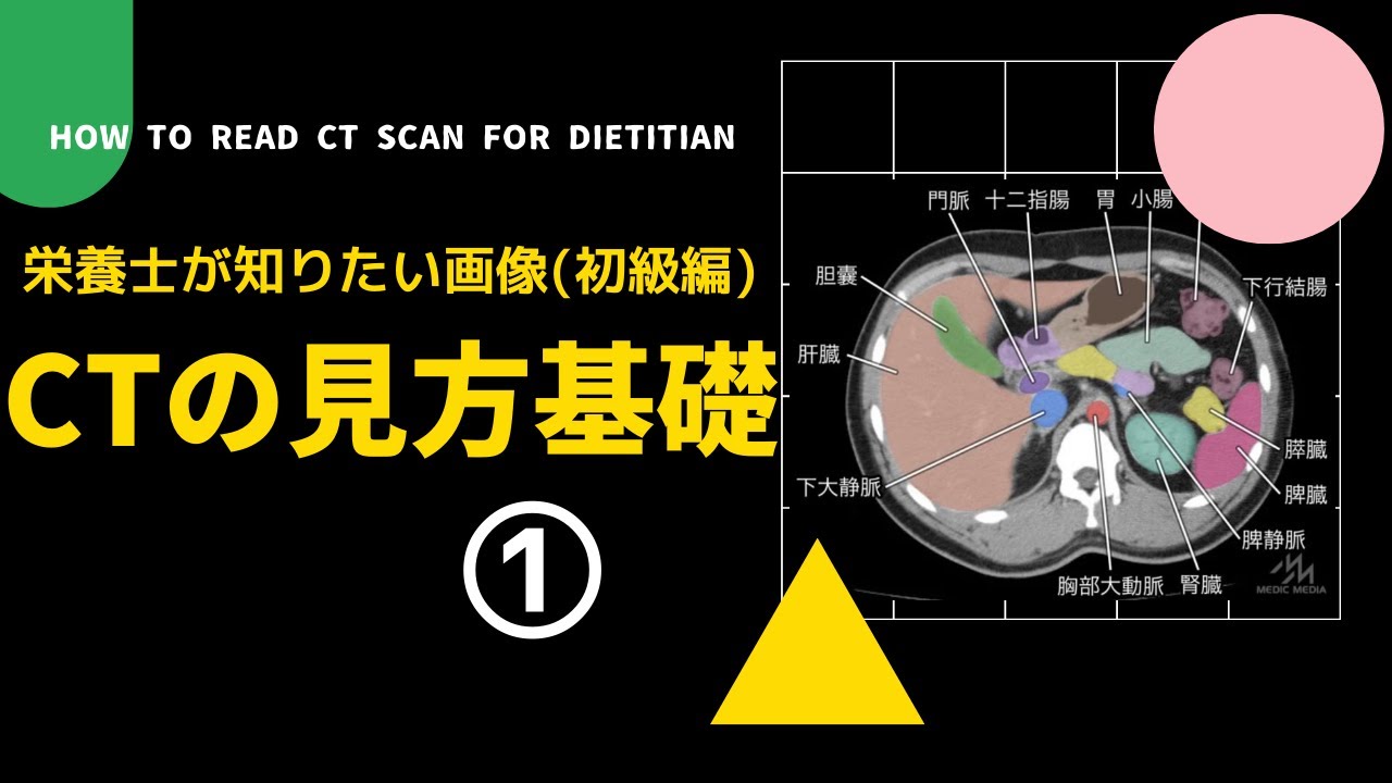 43 CT How To Read CT Scan For Dietitian YouTube 43-ct-how-to-read-ct-scan-for-dietitian-youtube