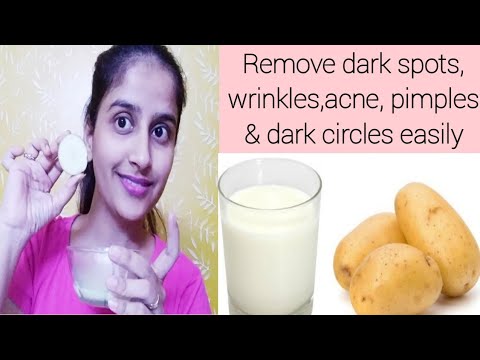 DIY Potato Face Wash remove dark spots, hyperpigmentation/skin ...