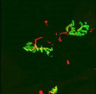 Normal NMJ c NF200 stain - YouTube