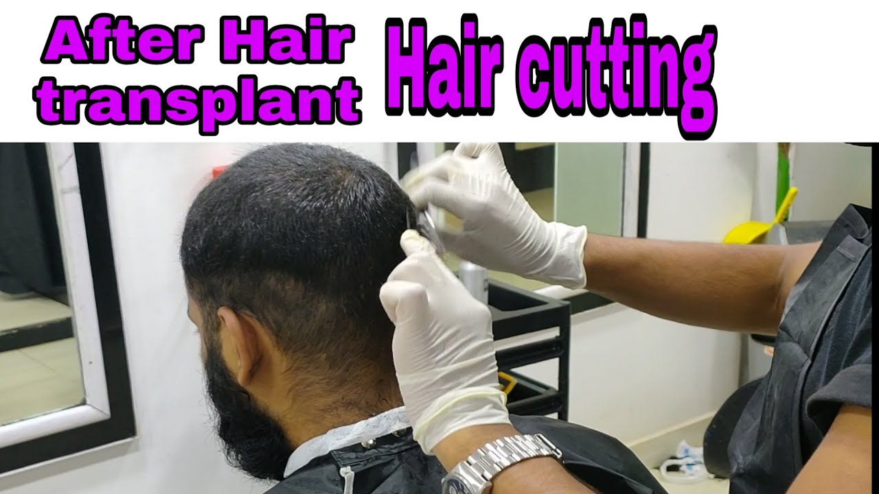 First Hair Cut After Hair Transplant || Donor area Cutting & Trimming ...