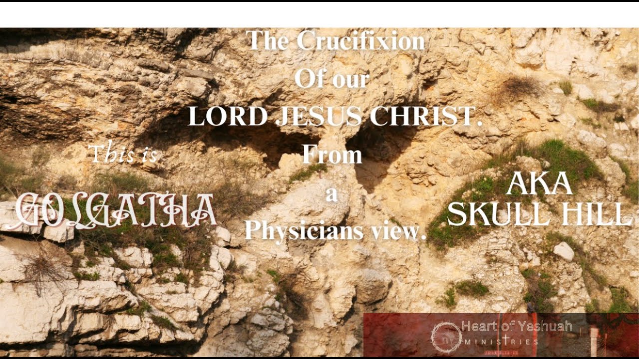 The CRUCIFIXION of our LORD and SAVIOR JESUS CHRIST. From a Medical ...