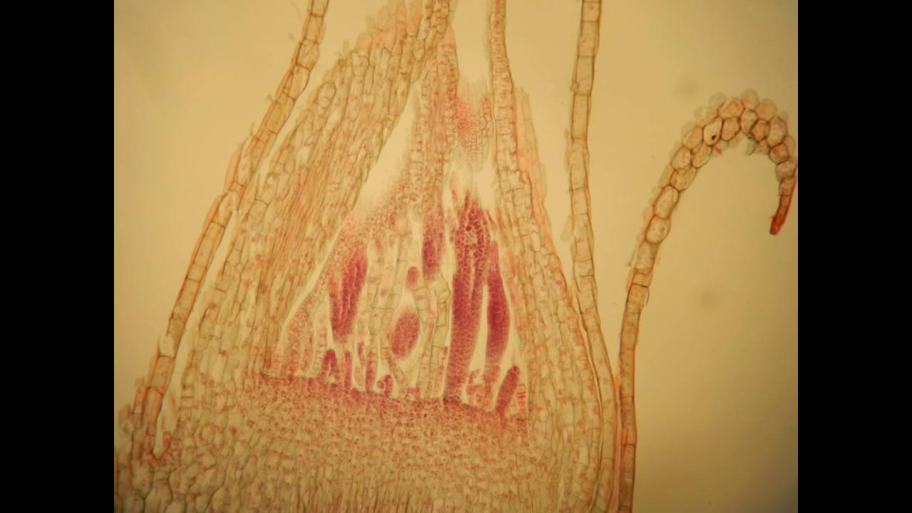 MOSS ARCHEGONIA SLIDES - YouTube