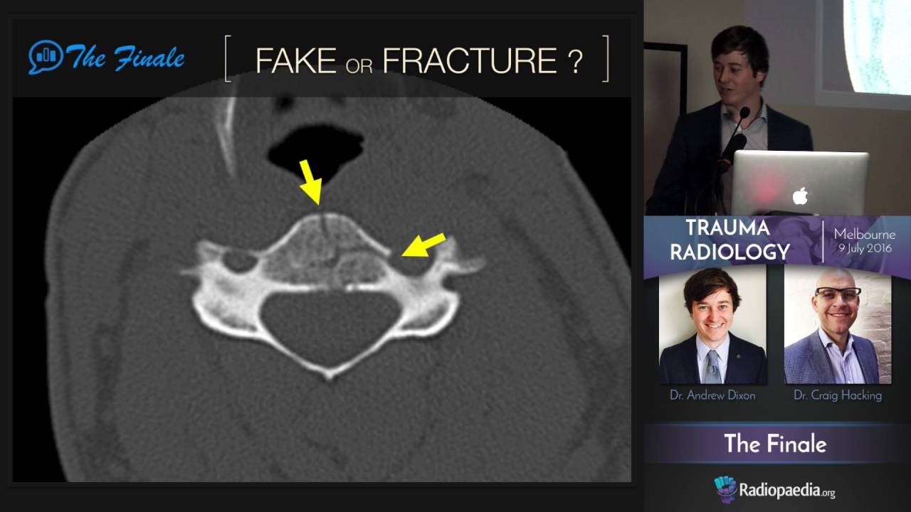 Trauma Radiology Course - Trailer - YouTube