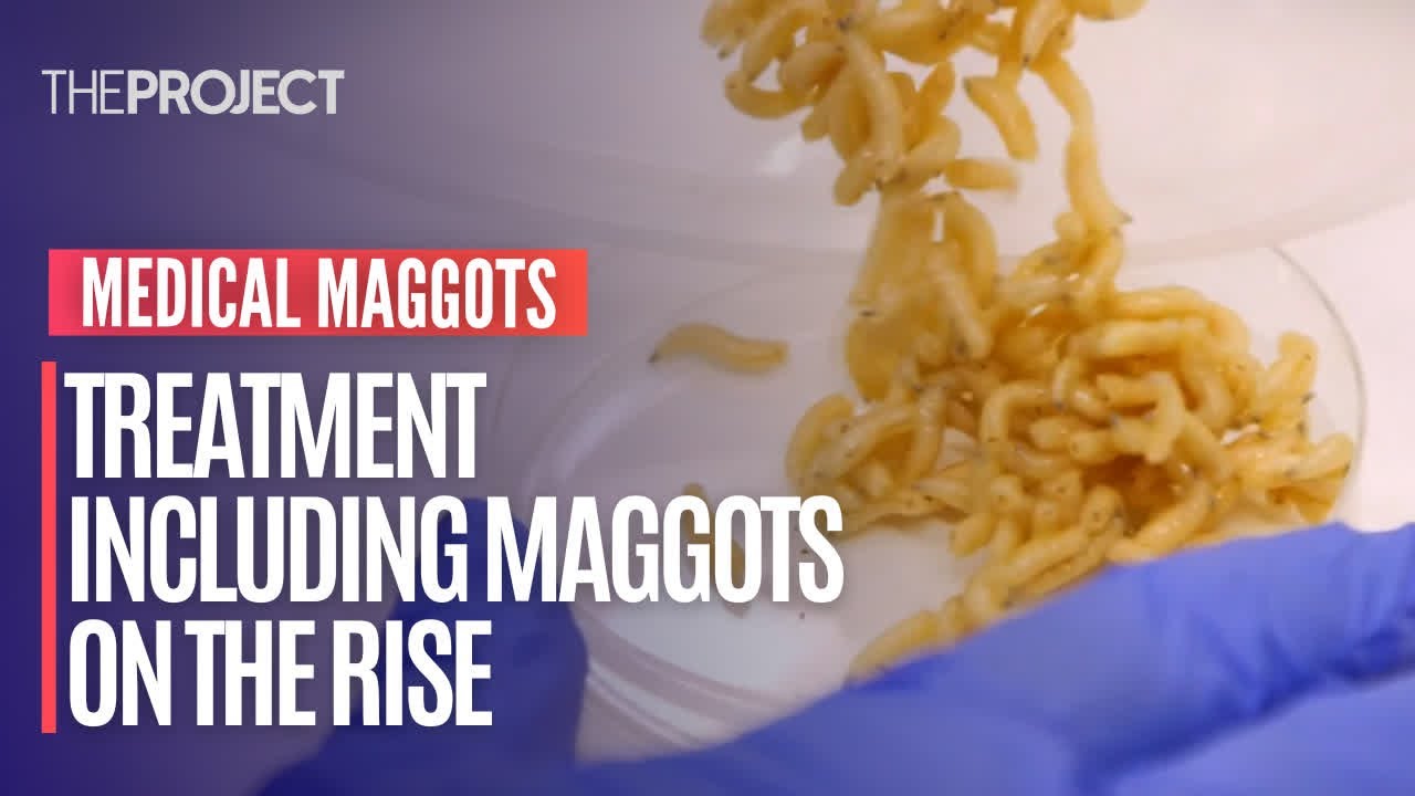 Medical Maggots: Treatment Including Maggots On The Rise Across The ...