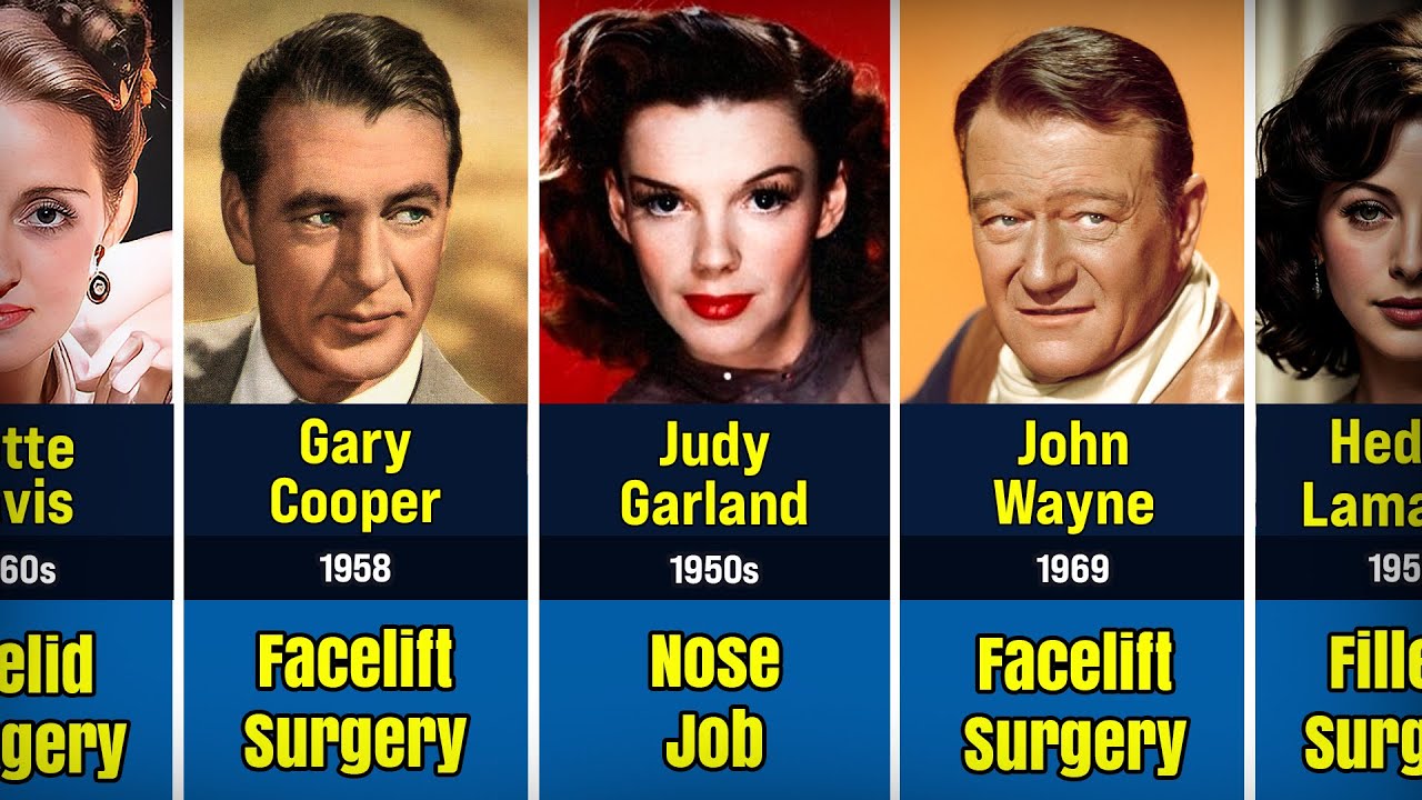 15 STARS WITH PLASTIC SURGERIES IN OLD HOLLYWOOD HISTORY, Here are ...