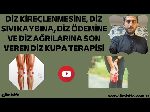 Diz Kireçlenmesine, Diz Sıvı Kaybına, Diz Ödemine ve Diz Ağrılarına Son ...