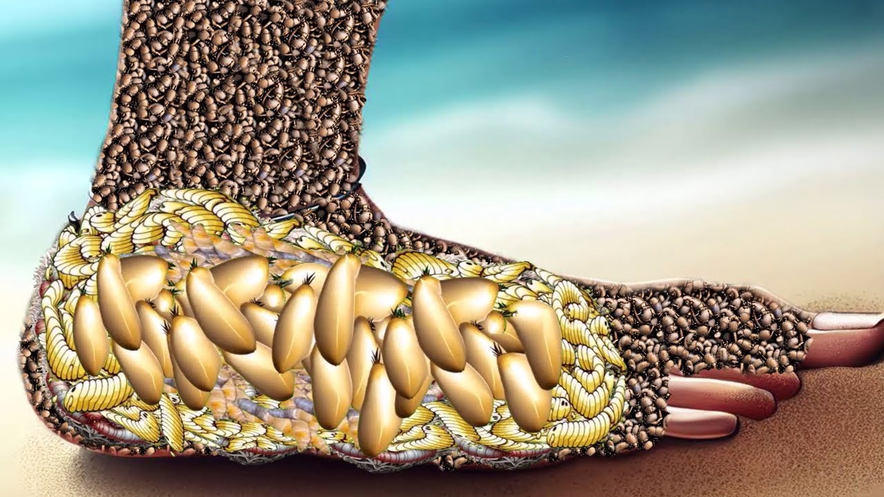 ASMR ANIMATION TREATMENT from Foot - YouTube