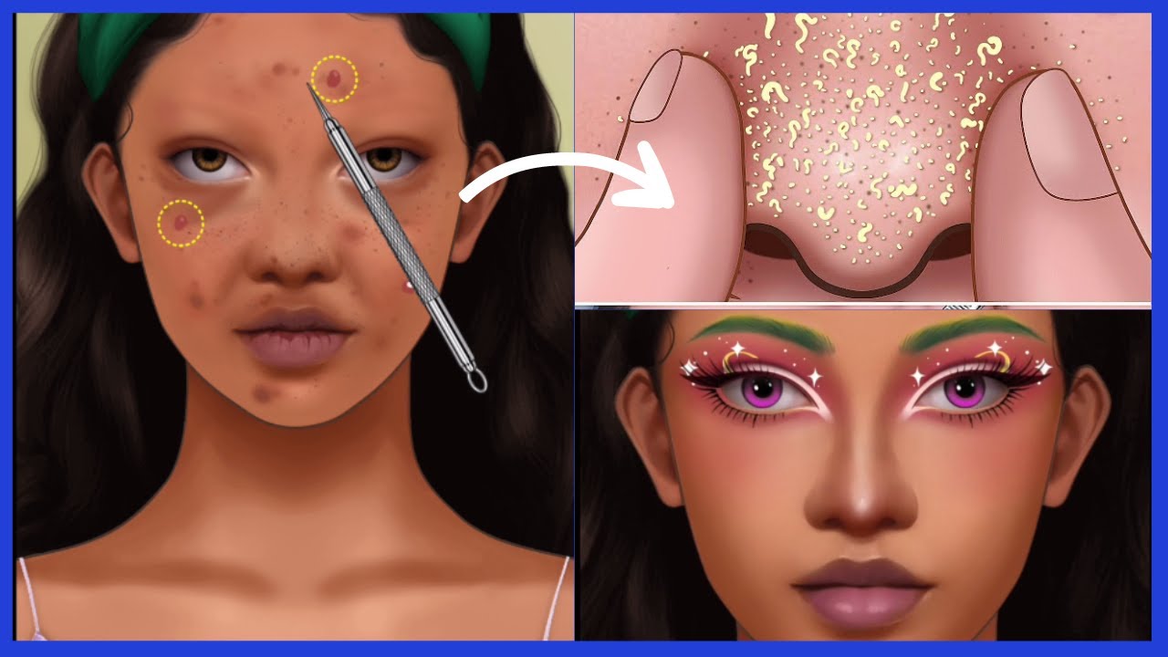 Blackhead & skin wart removal animation ASMR Makeup Video - YouTube