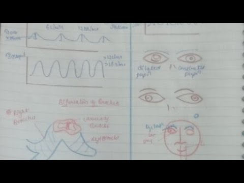 Gudells Stage Of Anesthesia - YouTube